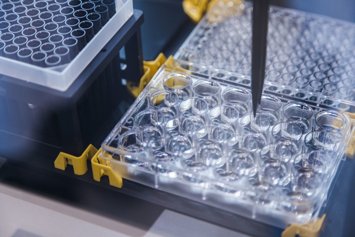 EpiScreen® 2.0: Immunogenicity Assessments Platform | Abzena